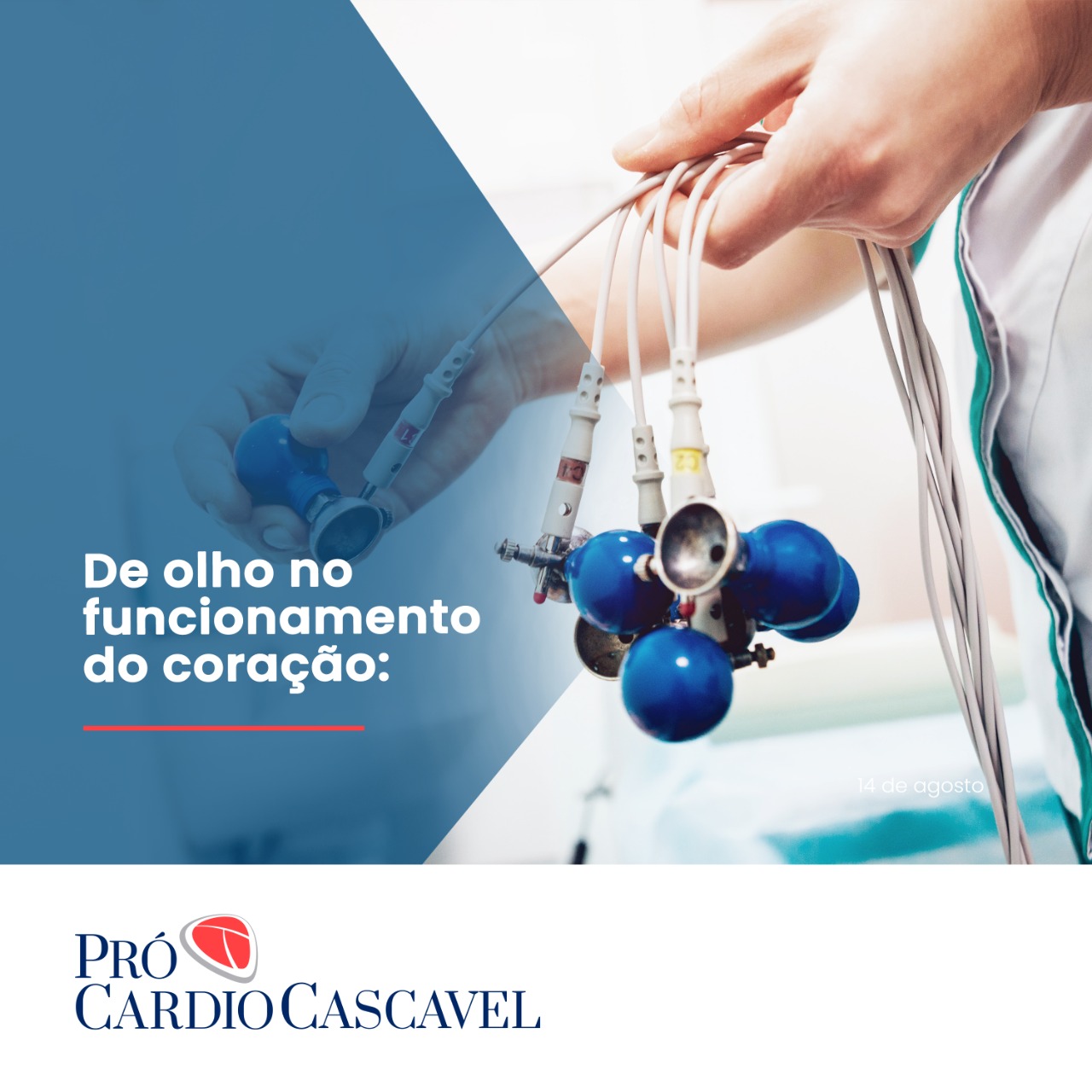 Pró Cardio Cascavel realiza exames para investigar arritmias - Básica ...